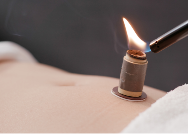 Moxibustion & Moxa Therapy | The Which Doctor South Yarra